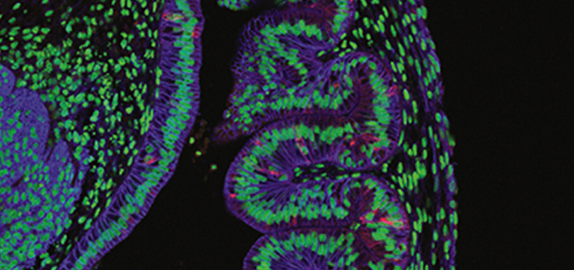 Stomach Organoid Success Advances Work to Build a Complete GI Tract on ...