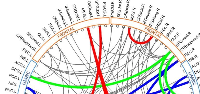 Artificial Intelligence Improves Ability to Use MRI to Diagnose ADHD ...