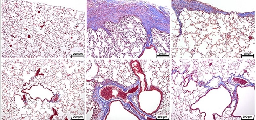 Pulmonary Fibrosis Treatment Shows Proof of Principle - Research Horizons