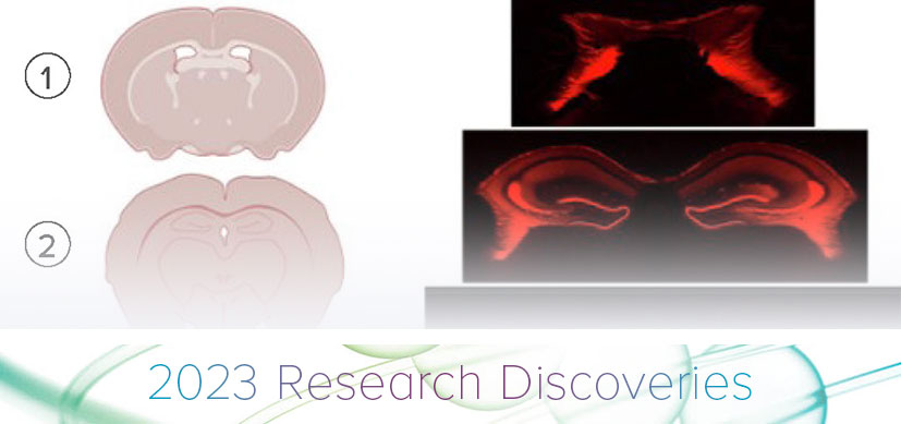 Potential Value Of Steroid Treatment For Status Epilepticus May Be Sex Dependent Research Horizons